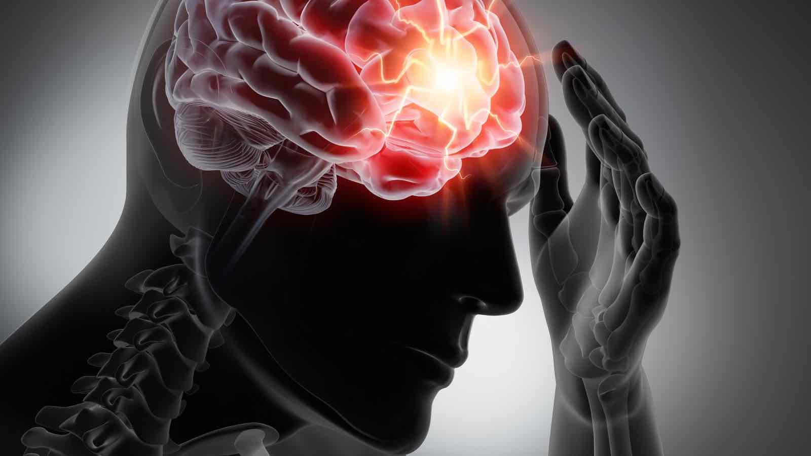 Traumatic brain injury (TBI) - Treatments - Richmod Hill,ON